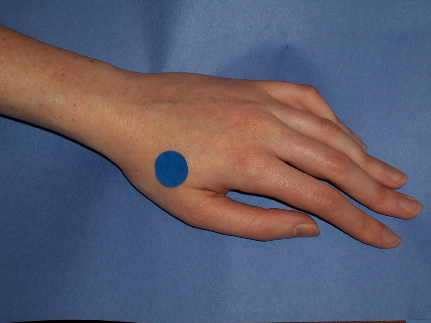 Acupressure for a Kid with a Headache » Alban Acupuncture