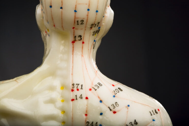 How acupuncture treats shoulder pain - Alban Acupuncture