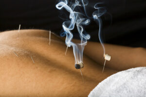 Traditional Chinese Medicine for Warts: A Natural, Painless Therapy